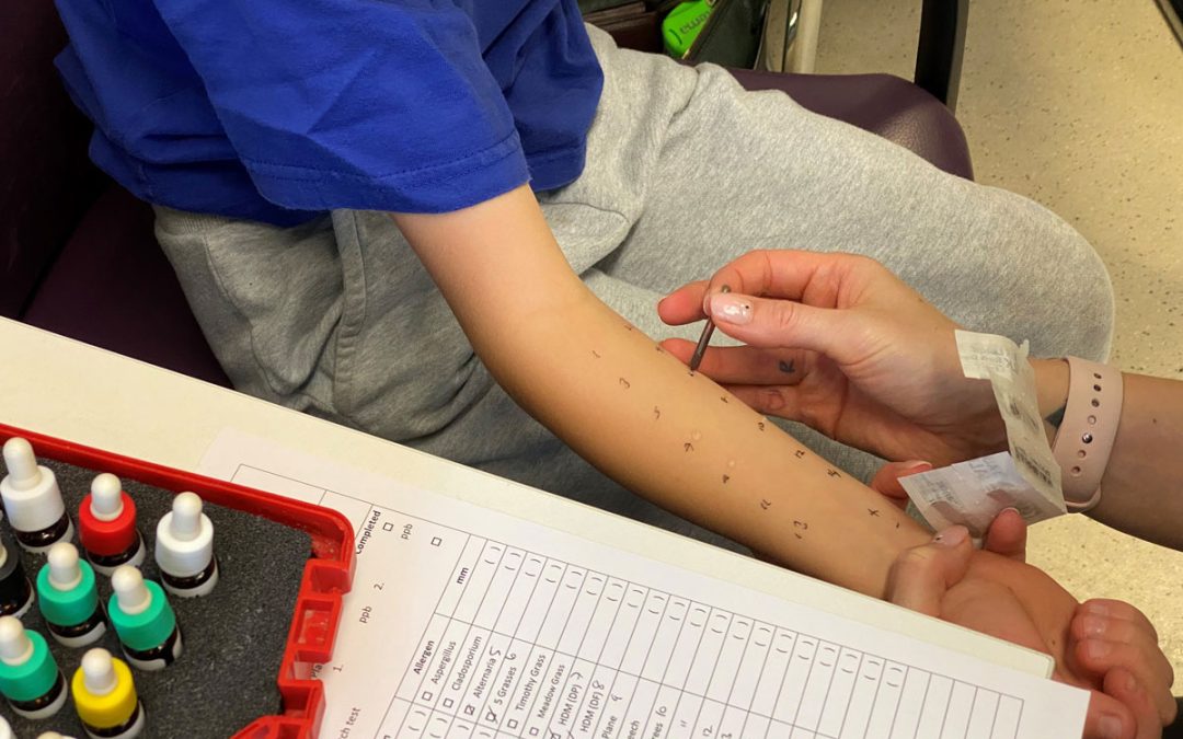 Featured | The Allergy Team